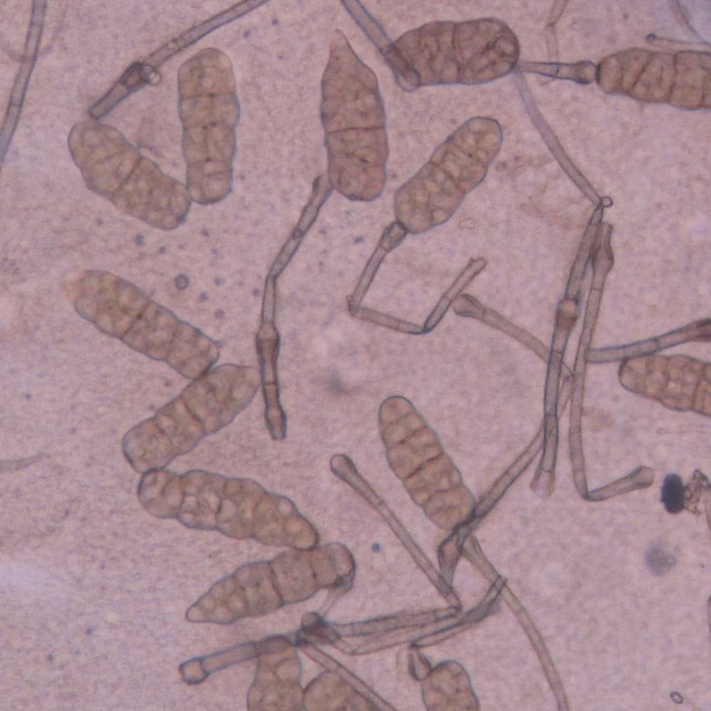 Alternaria allergi – symptomer, test og råd til lindring